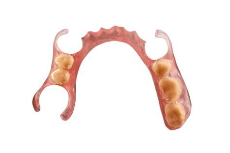 Partial Denture Fitting Process At Gemma Nock Blog