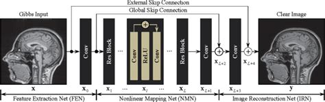 The Overall Network Structure Used In This Work Modified Edsr Model Download High