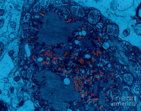 Rabies Virus Tem Photograph By Science Source Fine Art America