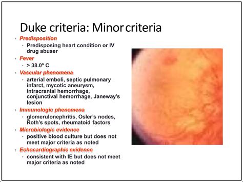Infective Endocarditis Paediatrics Pptx
