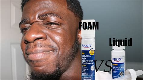 Rogaine Foam Vs Liquid Which One Is Better Minoxidil Journey Youtube