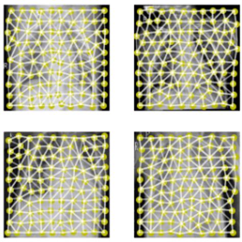 Pneumonia Graph Superpixels Kaggle