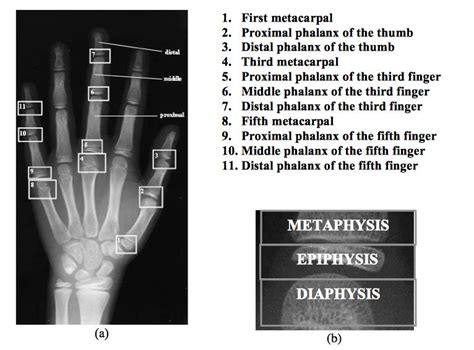 Sanders Classification Hand At Helen Porter Blog