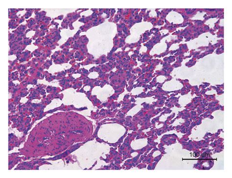 A D Pathological Sections Of Rat Lung Tissues In Each Group He Download Scientific Diagram