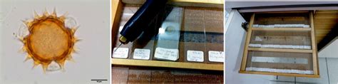 Asteraceae Pollen Grain On The Left Microscope Slides Labeled With