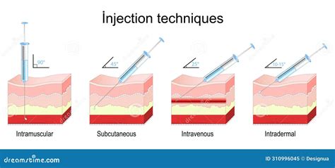 Injection Methods Intramuscular Subcutaneous Intravenous And