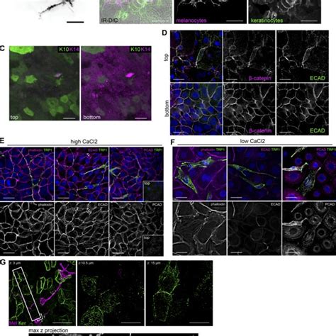 Spatiotemporal Characterization Of Localized Dendritic Ca²⁺ Transients