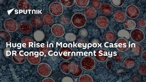 Huge Rise In Monkeypox Cases In Dr Congo Government Says 20072024