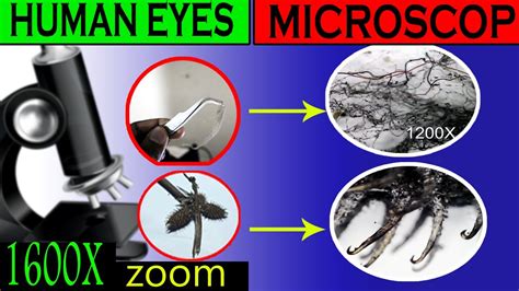 Human Eyes Vs Microscop Veiws With 1600x Zoomingamazing Views By