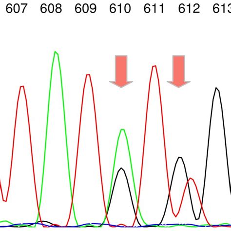 Sequencing Chromatogram The Sequencing Chromatogram Shows Two Nearby Download Scientific