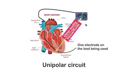 Basics Of Pacemaker Dr Hafeesh Fazulu Pushpagiri Pptx Heart And