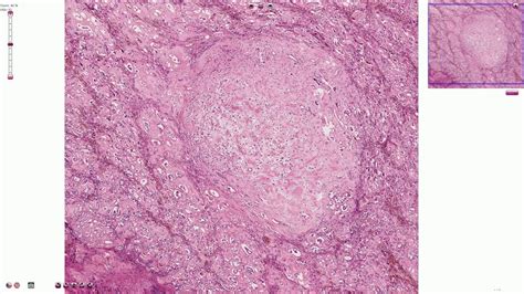 Interstitial Cells Histology