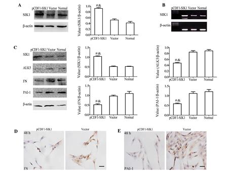 Salt Inducible Kinase Is Involved In High Glucose Induced Mesangial Cell Proliferation
