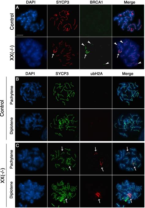 Figure 1 From Role Of Polycomb Group Protein Cbx2 M33 In Meiosis Onset And Maintenance Of