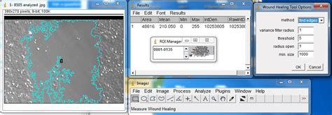 Any Of You Know How To Use Mri Wound Healing Tool Of Imagej To Analyse