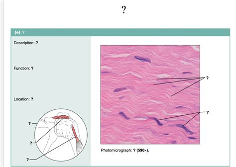 Tissue 14 Diagram Quizlet