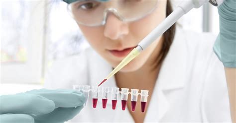 Vumerity Diroximel Fumarate