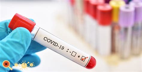 Teste De Covid 100 Nacional EstÁ Em Fase Final De ProduÇÃo Carmo Web Tv
