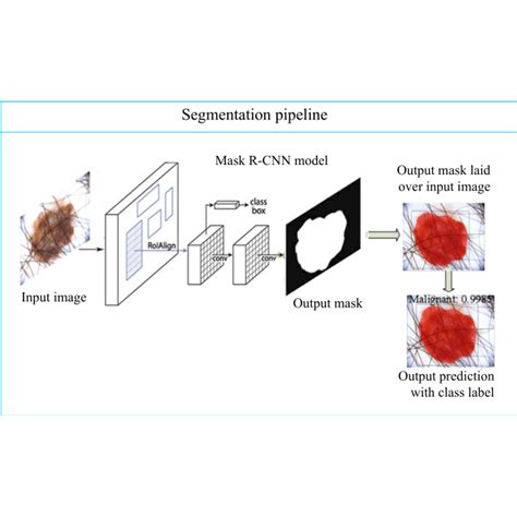 Proposed Segmentation Pipeline Download Scientific Diagram