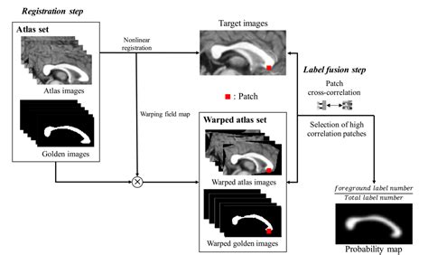 Figure 2 From Automatic Segmentation Of Corpus Callosum In Midsagittal Based On Bayesian
