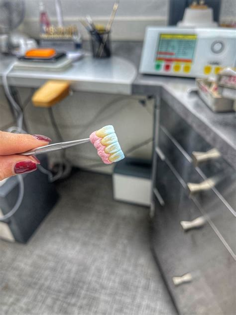 Erij Ben Mefteh On Linkedin Bridgesurimplant Faussegencive