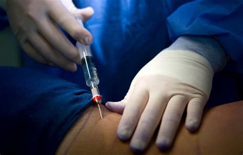 Higher Prevalence Of Occult Hypoxemia Found During Anesthesia In Black