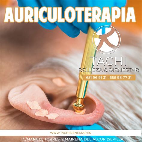 Auriculoterapia En Sevilla Tachi Salud Y Bienestar