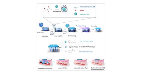 A Bilayer Microneedle For Modulated Sequential Release Of Adrenaline And Lidocaine For Prolonged