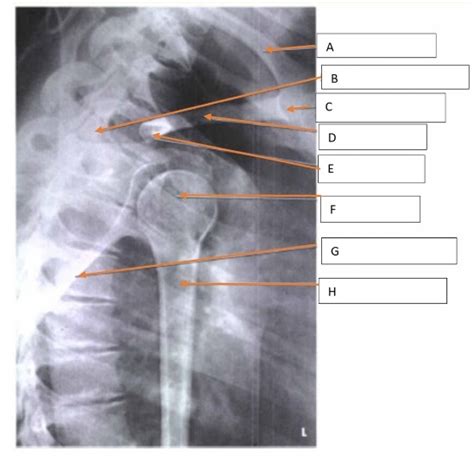 Transthoracic Humerus Labeling Diagram Quizlet