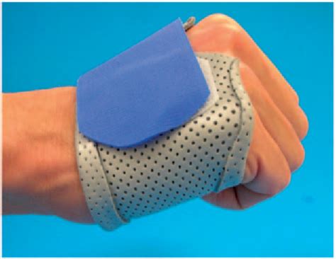 Ulnar Gutter Splint For 5th Metacarpal Fracture