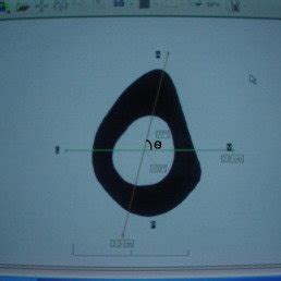 Mid Shaft Cross Section Of A Tibia The Angle H Which Determines The Download Scientific