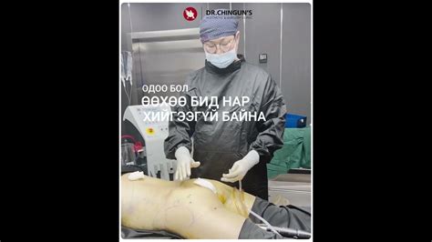 Өөх шилжүүлэн суулгах мэс засал Youtube