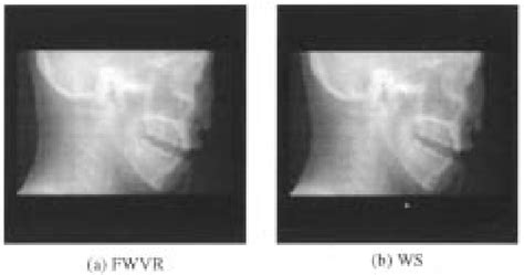 Figure 11 From Frequency Domain Volume Rendering By The Wavelet X Ray