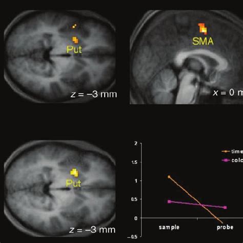 General Timing Network Areas Of The Frontal Cortex Showing Enhanced Download Scientific
