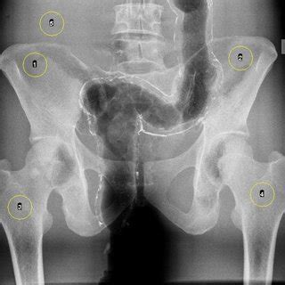 Regions Of Interest Used For SNR Calculations Bone Which Were Download Scientific Diagram