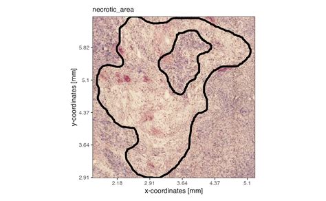 Using Spatial Annotations • Spata2