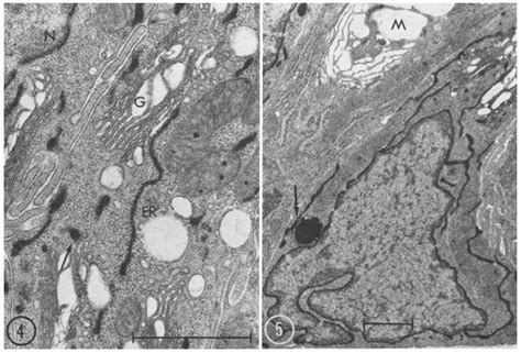 This Micrograph Illustrates The Localization Of Peroxidase Reaction In