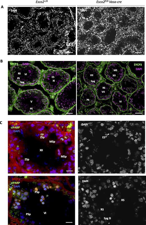 Meiotic Sex Chromosome Cohesion And Autosomal Synapsis Are Supported By