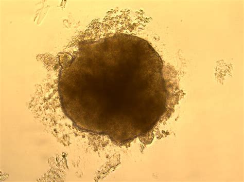 pipeline to segment organoid live imaging image analysis image sc forum