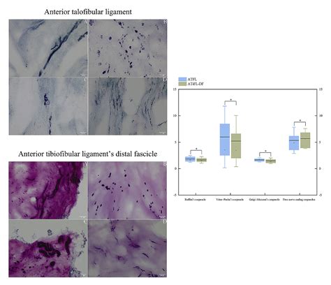 Figure 7 From Chronic Lateral Ankle Instability Using Anterior