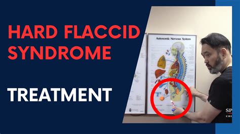 Hard Flaccid Syndrome Chiropractor Manhattan