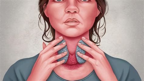 Premium Photo The Woman Has A Thyroid Disorder Sore Throat Inflamed