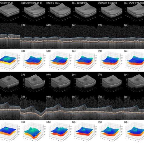 Qualitative Result Of Different X Motion Correction Methods On