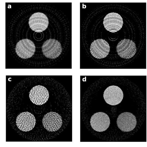 Influence Of Different Suppression Parameters On Iterative