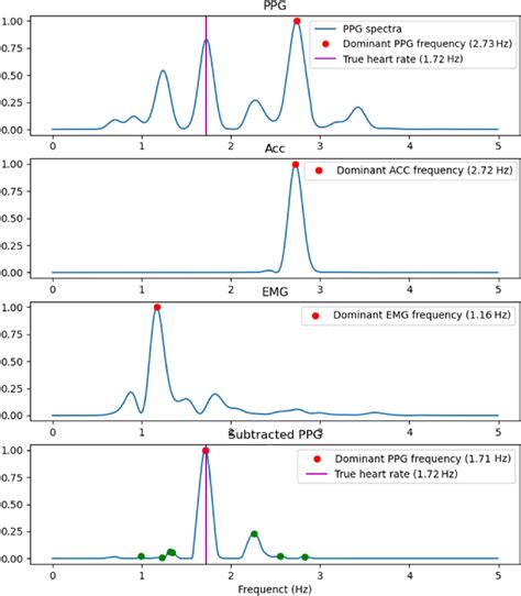 Figure 1 From The Use Of Wrist Emg Increases The Ppg Heart Rate Accuracy In Smartwatches