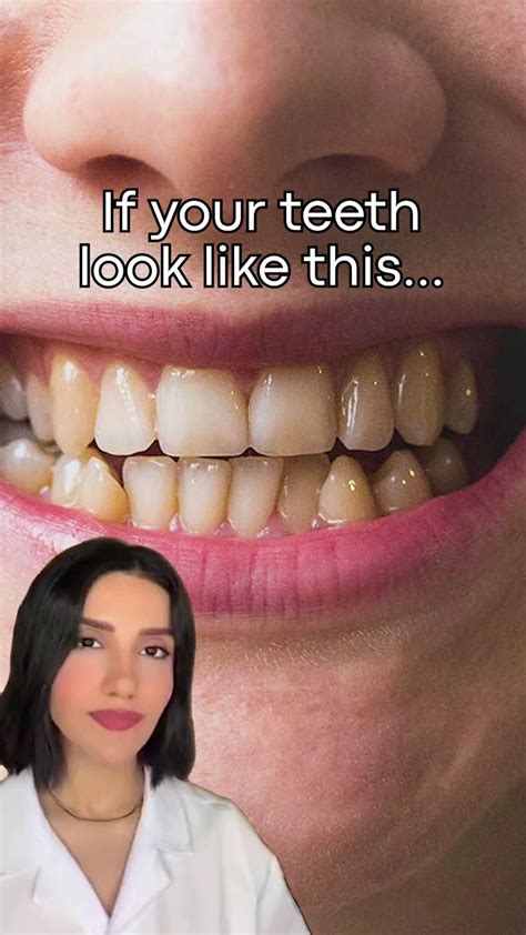 Best 13 The Best Whitening Toothpaste Artofit
