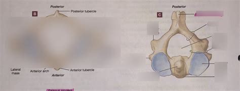 Axis C2 Diagram Quizlet