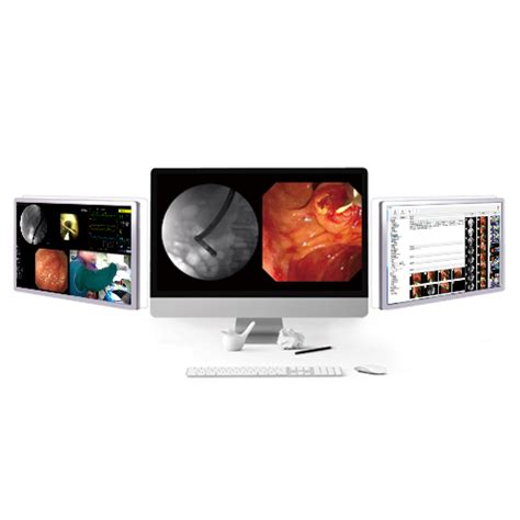 智慧ercp系统 医学影像工作站 4k医用刻录机 手术示教 手术直播 南京索图科技有限公司