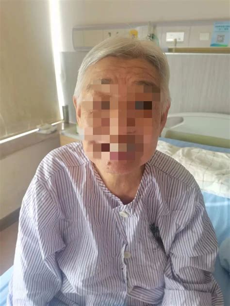 邵永孚教授：78岁患者ct示胰颈部占位，考虑胰腺神经内分泌癌，应作何种术式？