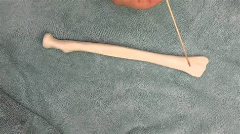 Radius Diagram Quizlet